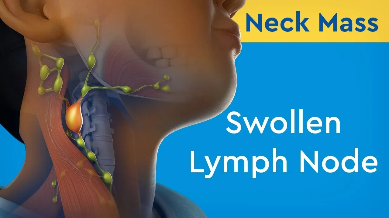 Can Allergies Cause Swollen Lymph Nodes? Floral Park Guide